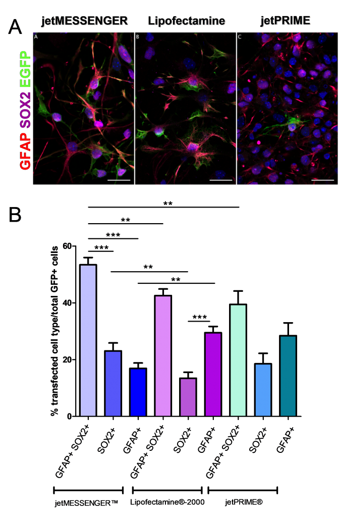 Transient gene expression in neurosphere with jetMESSENGER®