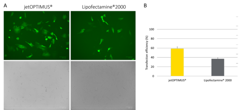 Improved transfection efficiency of neural cells using jetOPTIMUS® and ...