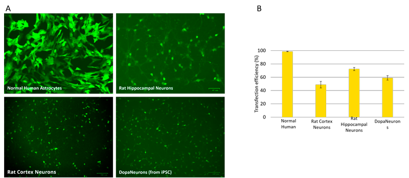 Improved transfection efficiency of neural cells using jetOPTIMUS® and ...